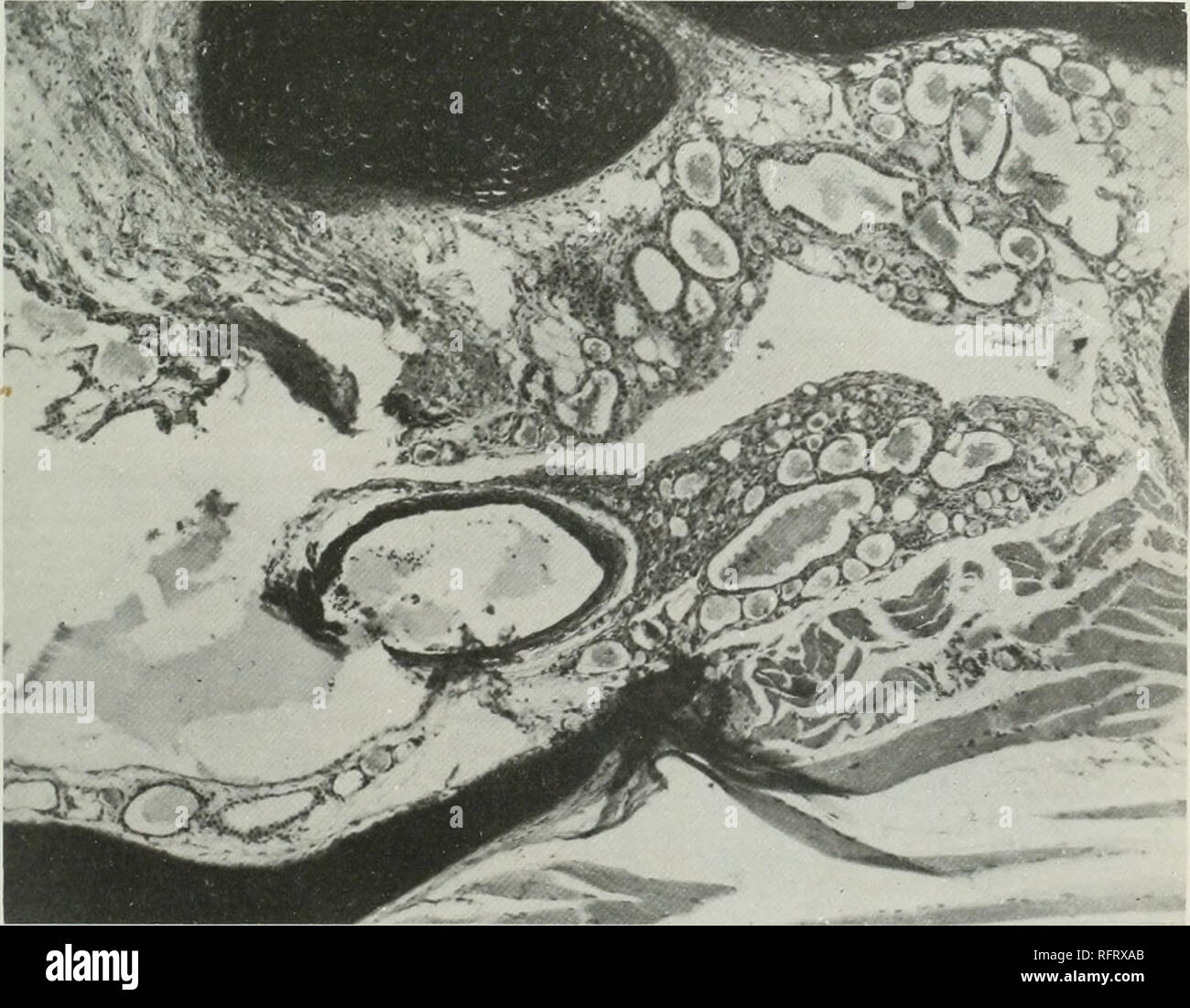 . Carcinoma of the thyroid in the salmonoid fishes. Cancer; Goiter ...