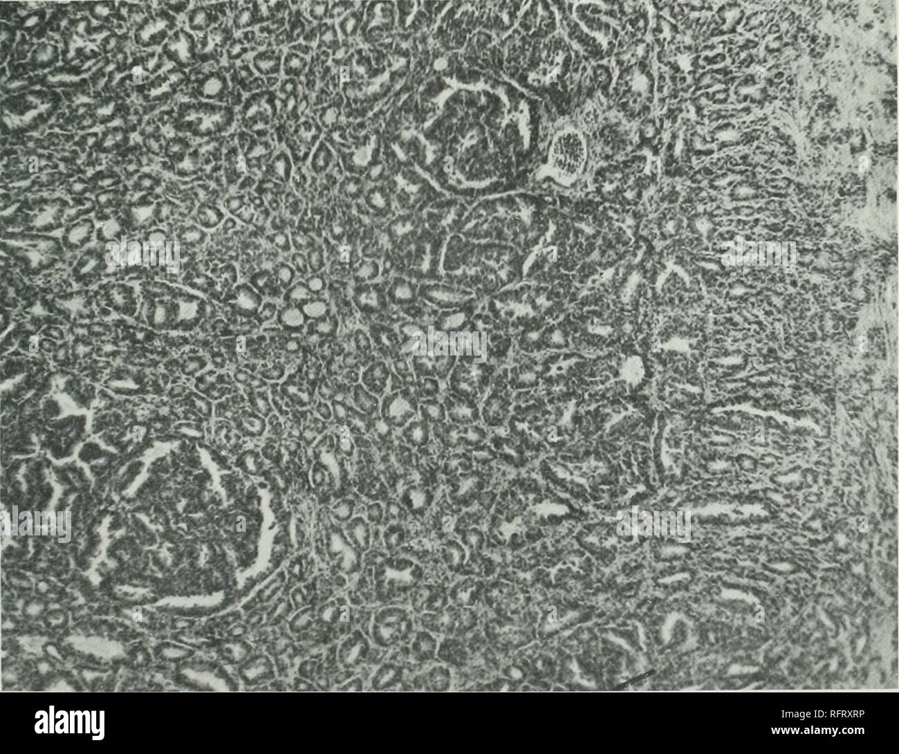 . Carcinoma of the thyroid in the salmonoid fishes. Cancer; Goiter ...
