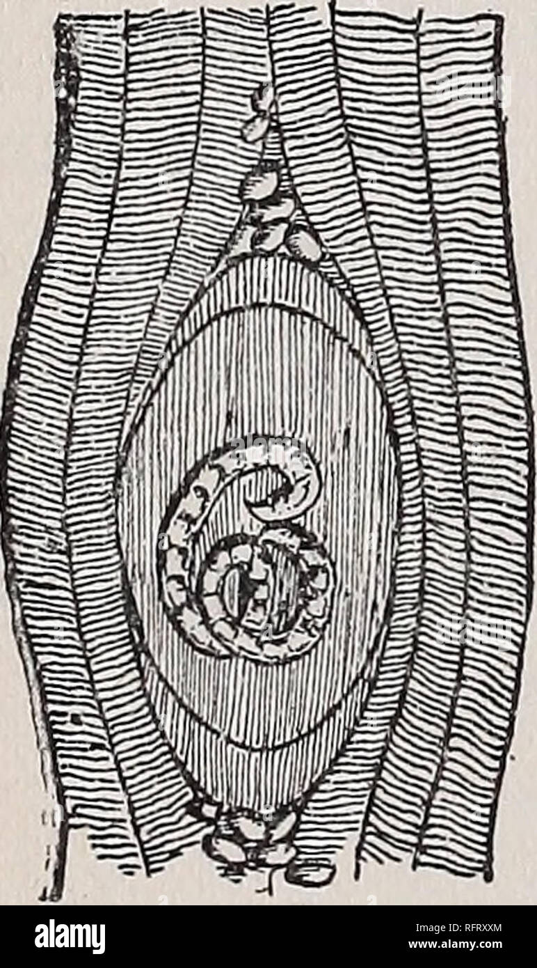 Trichina spiralis hi-res stock photography and images - Alamy