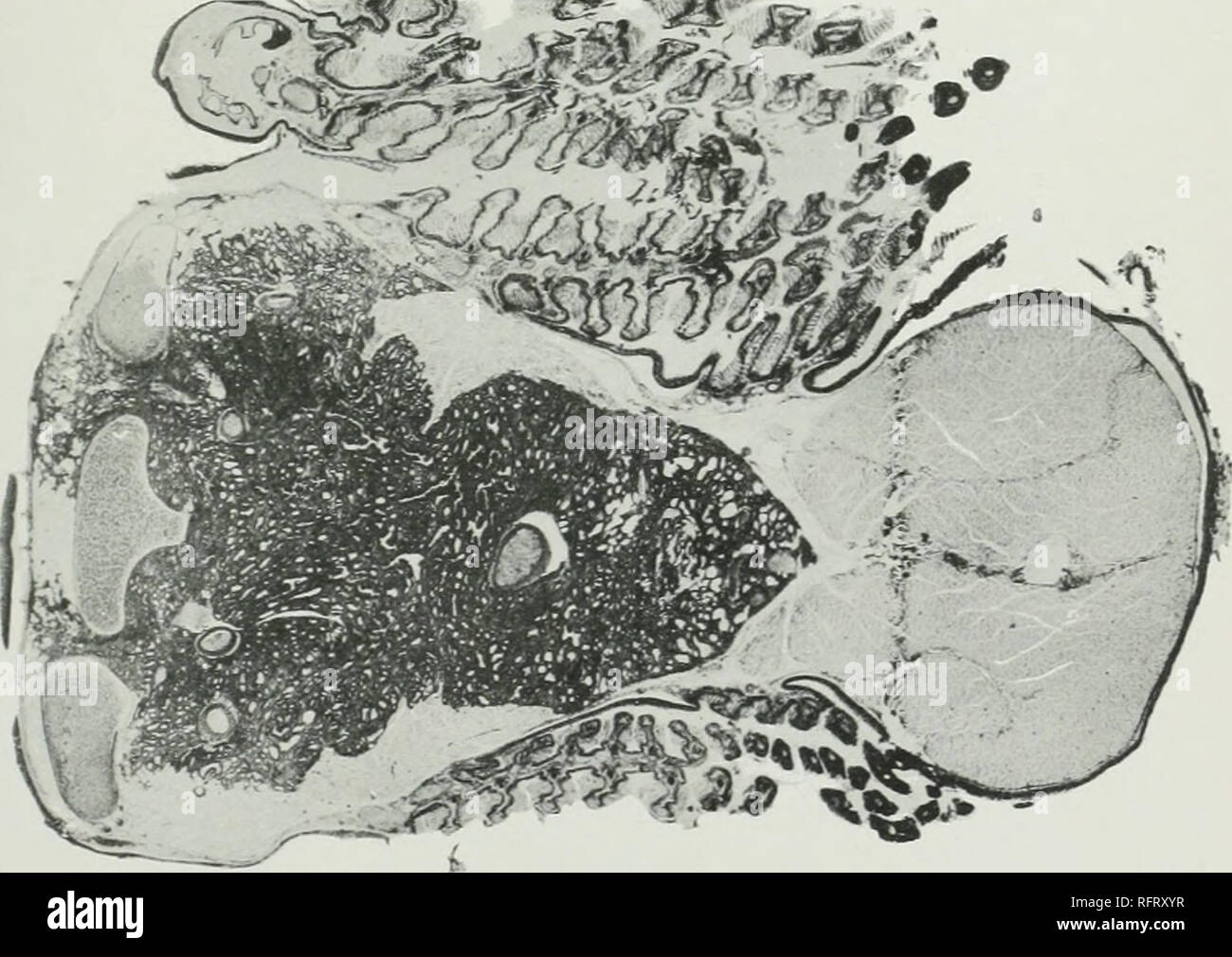 Thyroid gland cross section hi-res stock photography and images - Alamy