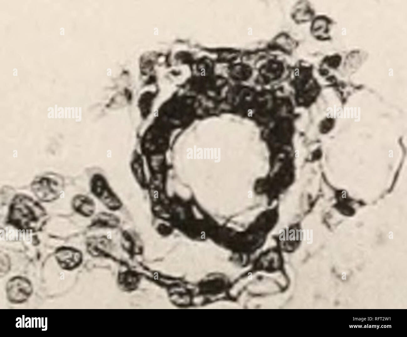 Two larger vesicles hi-res stock photography and images - Alamy