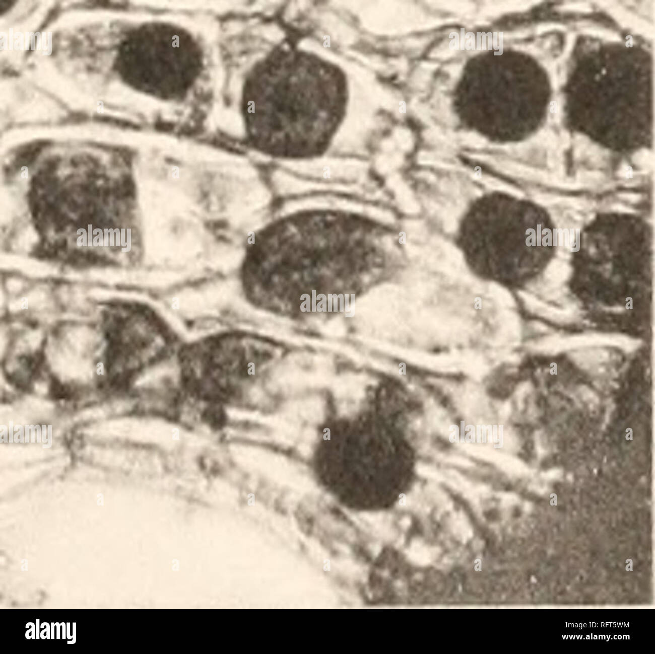 Tylose hi-res stock photography and images - Alamy