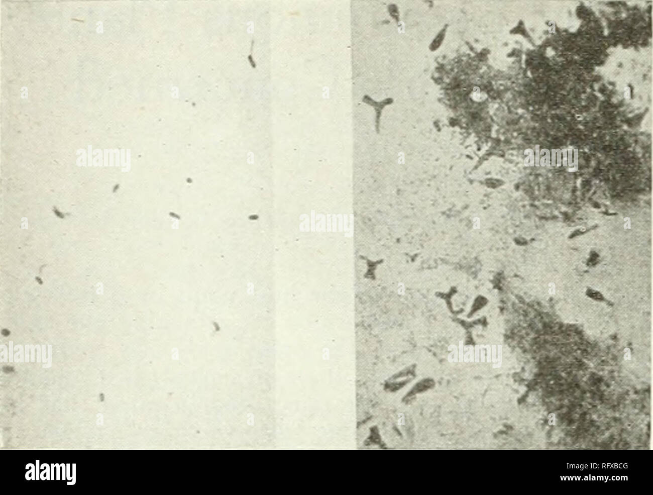 Root nodules bacteria hi-res stock photography and images - Alamy