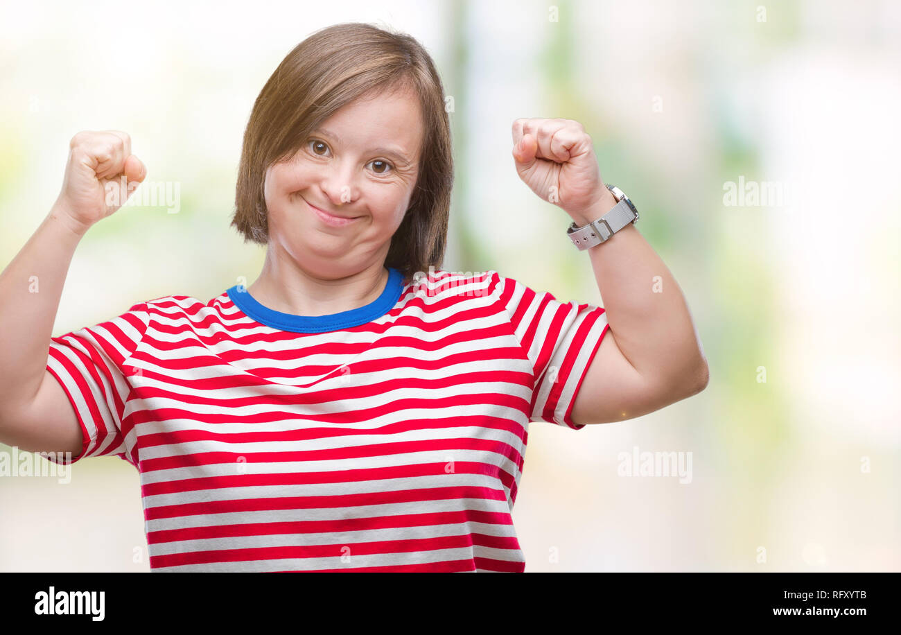Young adult woman with down syndrome over isolated background showing ...