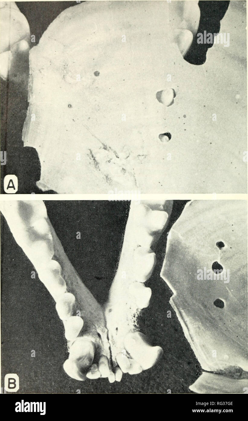 Perfectly aligned teeth hi-res stock photography and images - Alamy