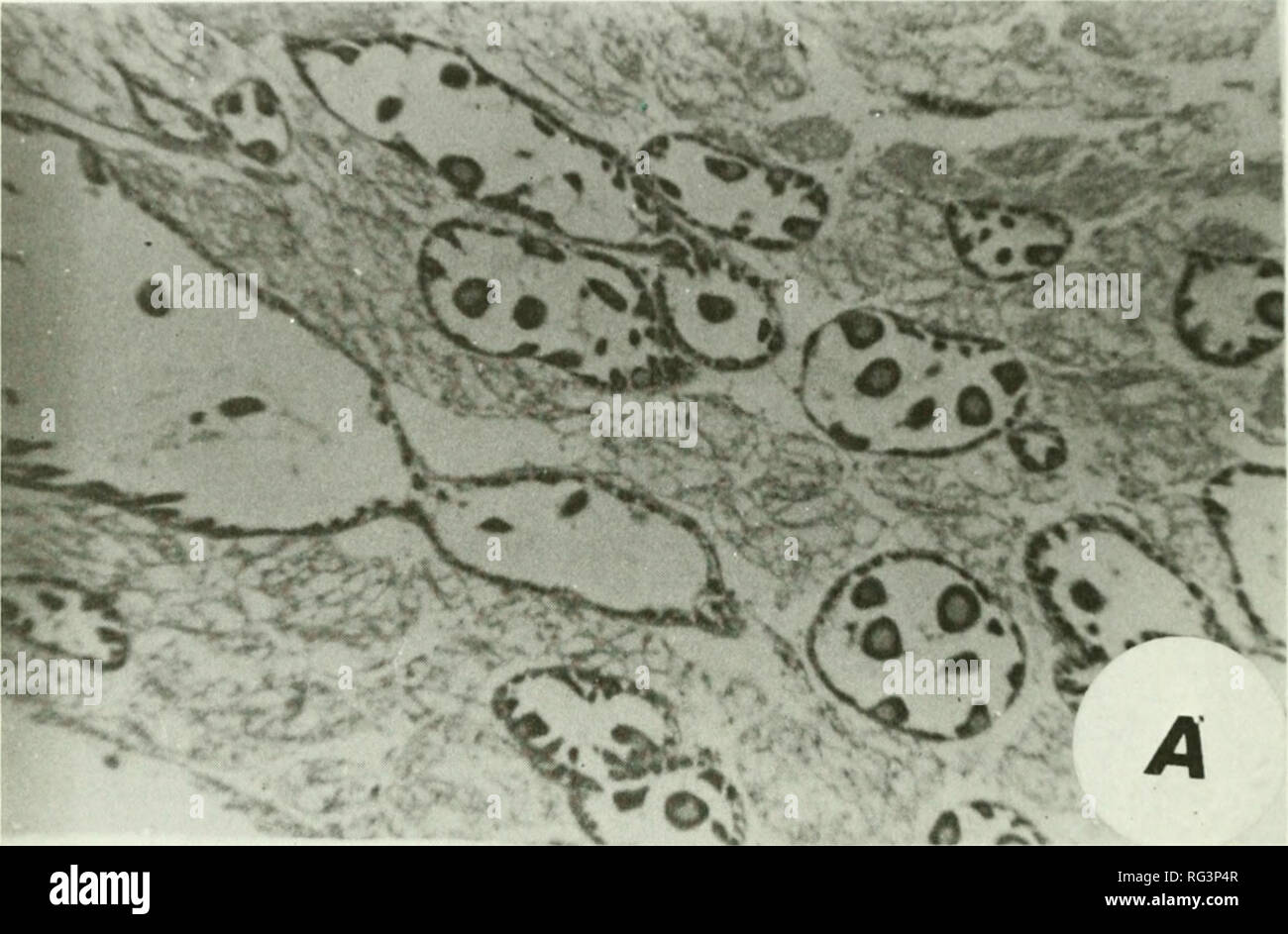 Follicle wall hi-res stock photography and images - Alamy