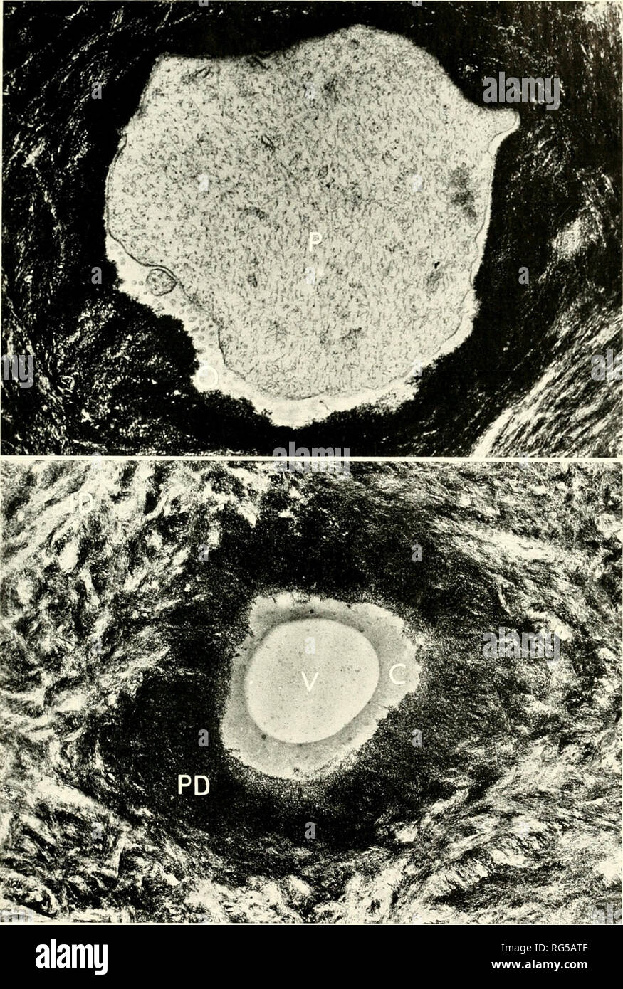 Dentinal tubule hi-res stock photography and images - Alamy