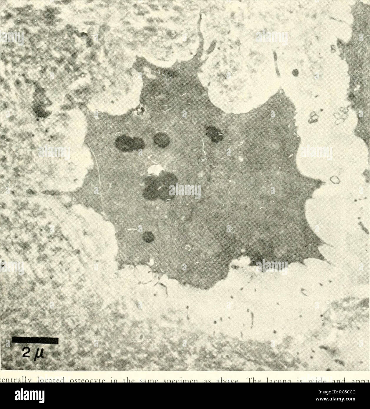 . Calcified tissues; proceedings. Bone; Collagen; Calcification. The ...