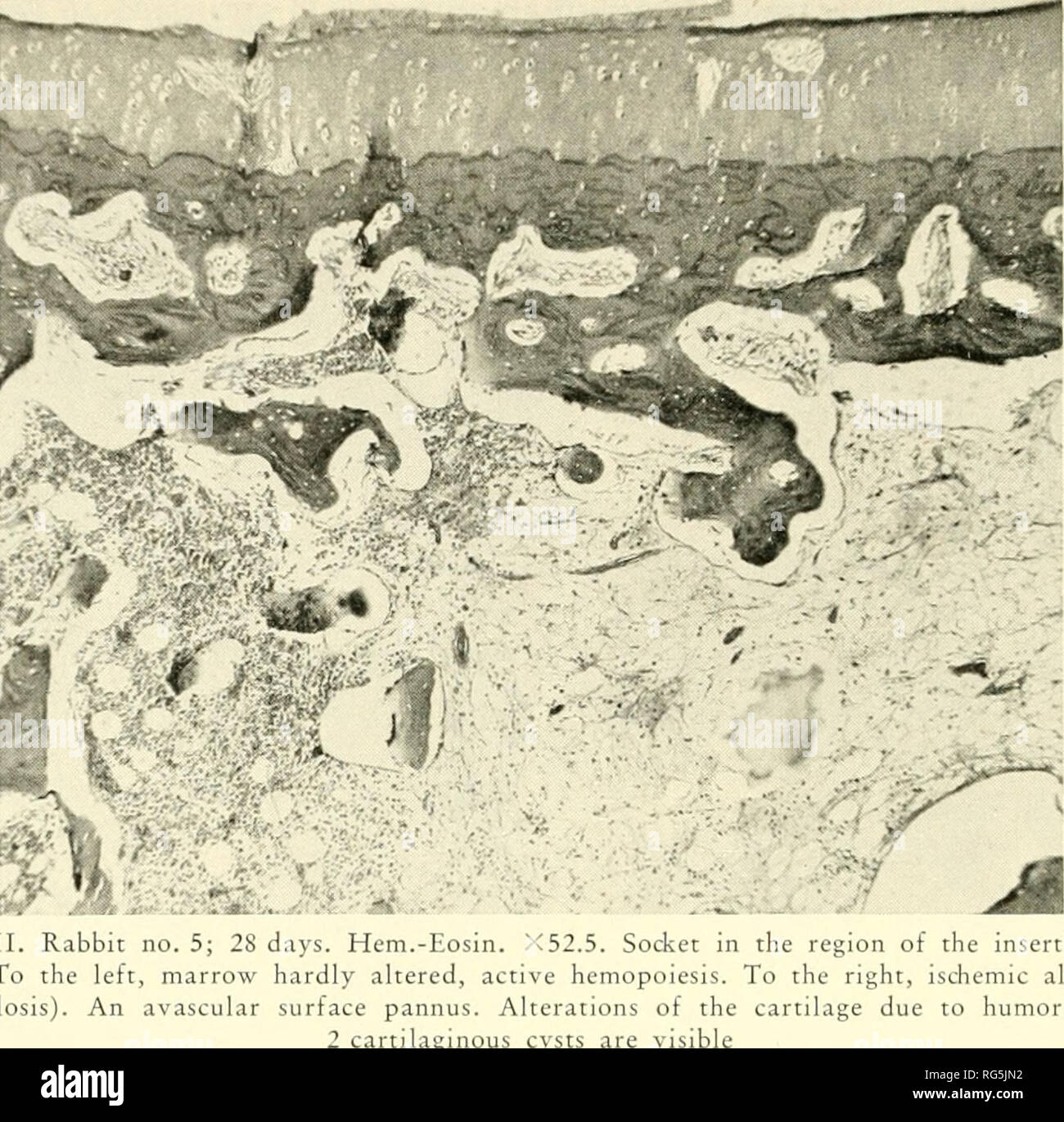 Reticulosis hi-res stock photography and images - Alamy