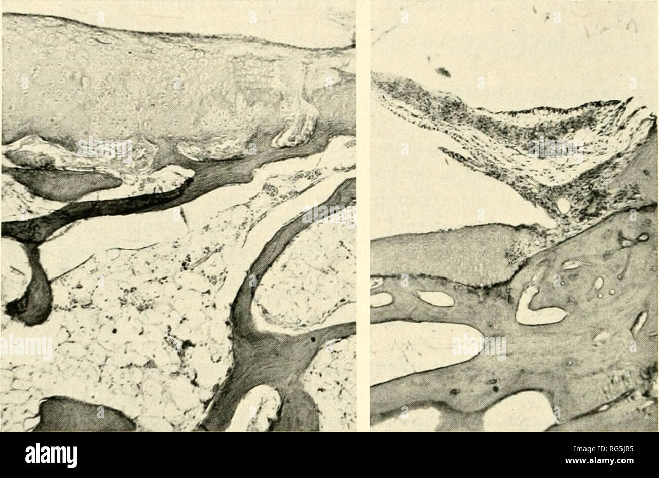 . Calcified tissues; proceedings. Bone; Collagen; Calcification. 64 E ...