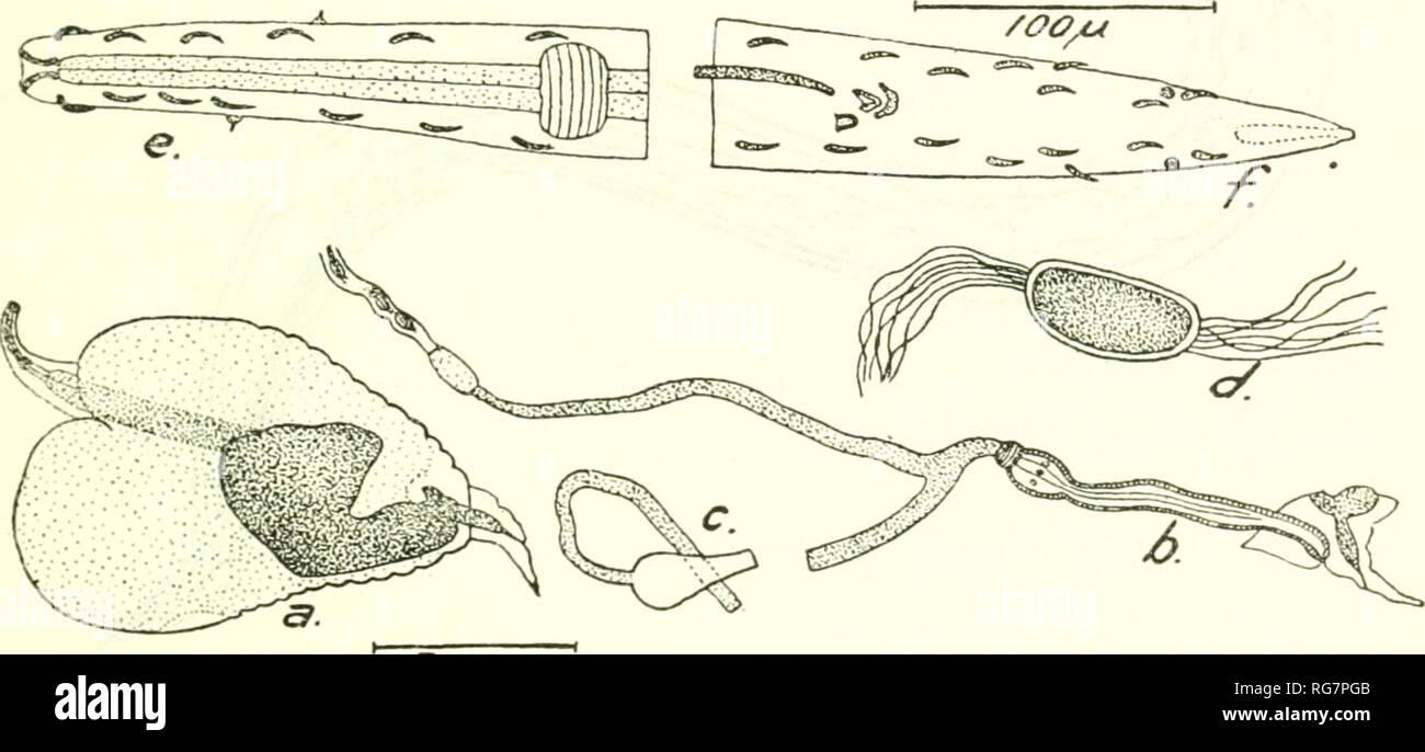 Cervical ring hi-res stock photography and images - Alamy