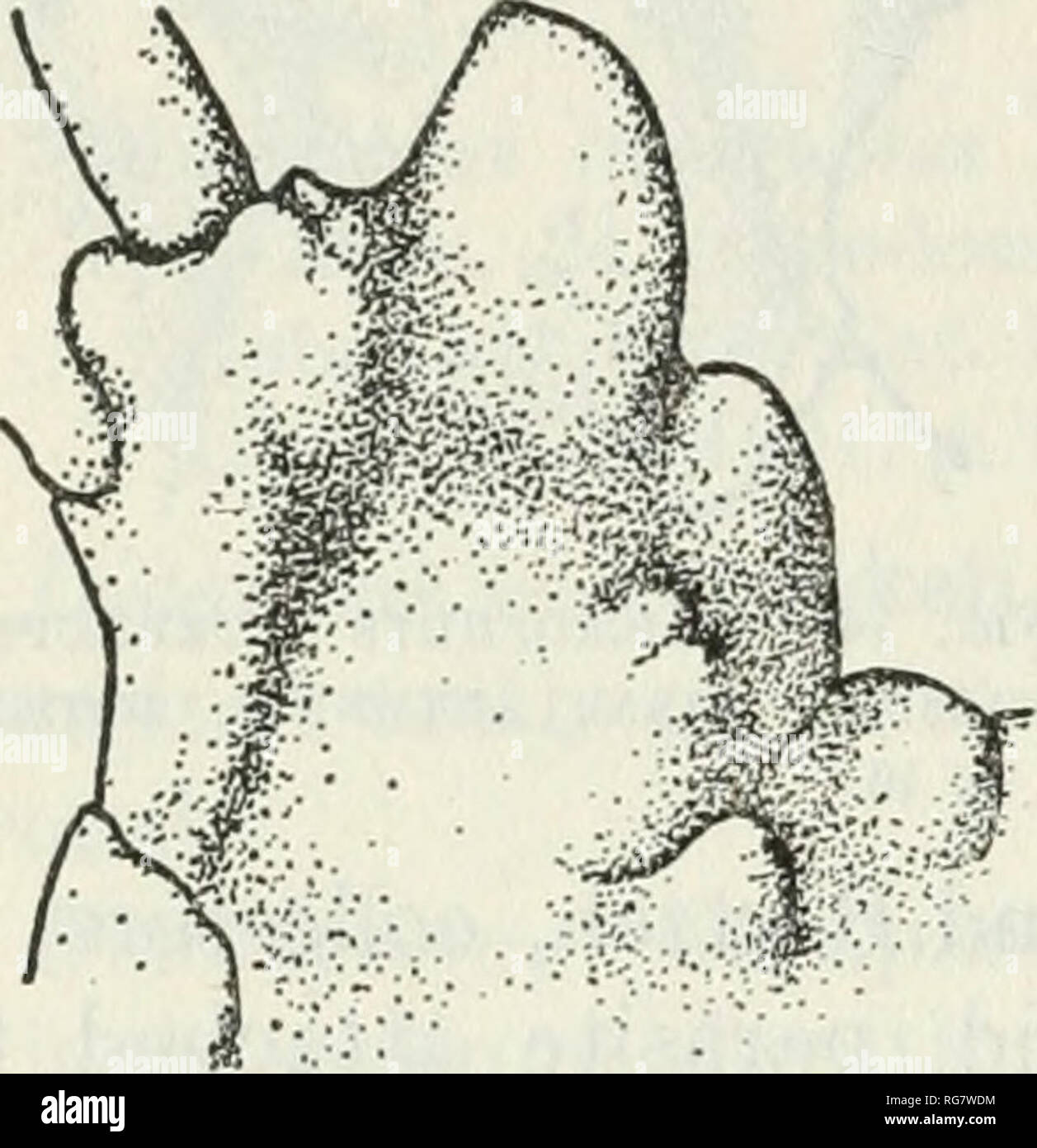 Epigastric region hi-res stock photography and images - Alamy