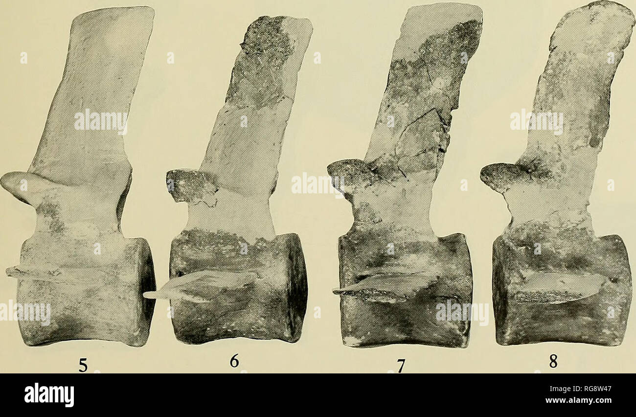 5 lumbar vertebrae hi-res stock photography and images - Alamy