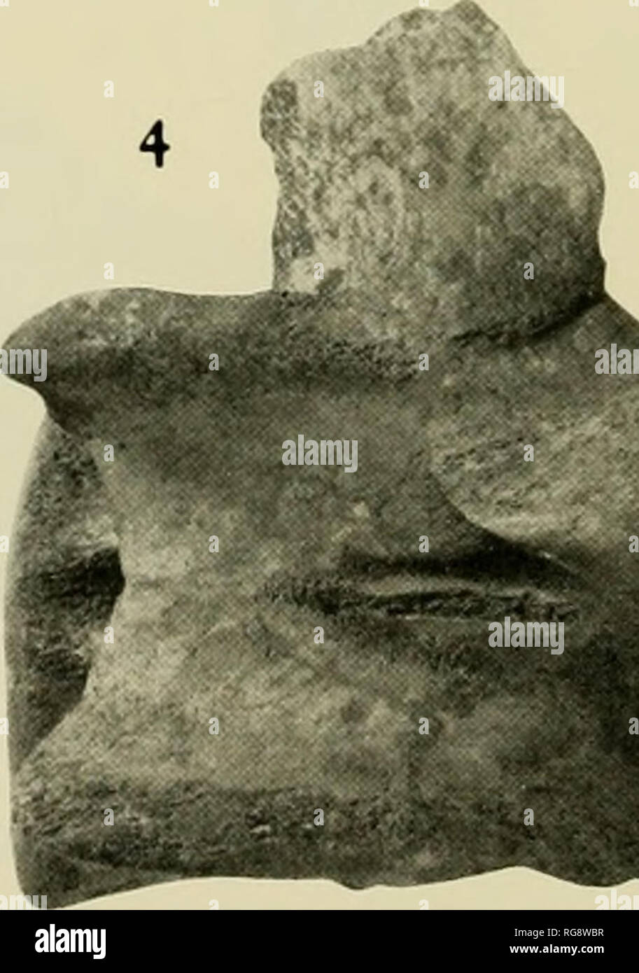 Third lumbar vertebrae hi-res stock photography and images - Alamy