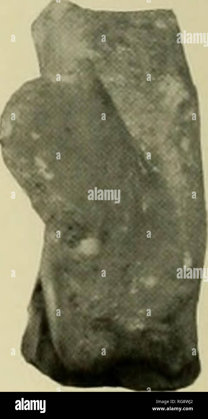 Cervical vertebrae 7 hi-res stock photography and images - Alamy