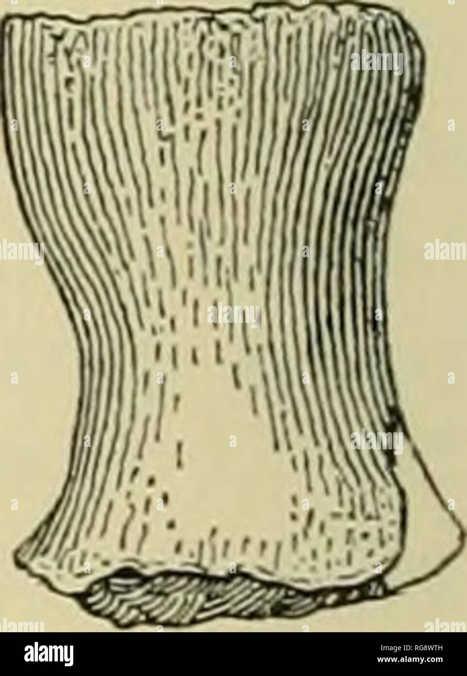 Distal row of carpal bones hi-res stock photography and images - Alamy