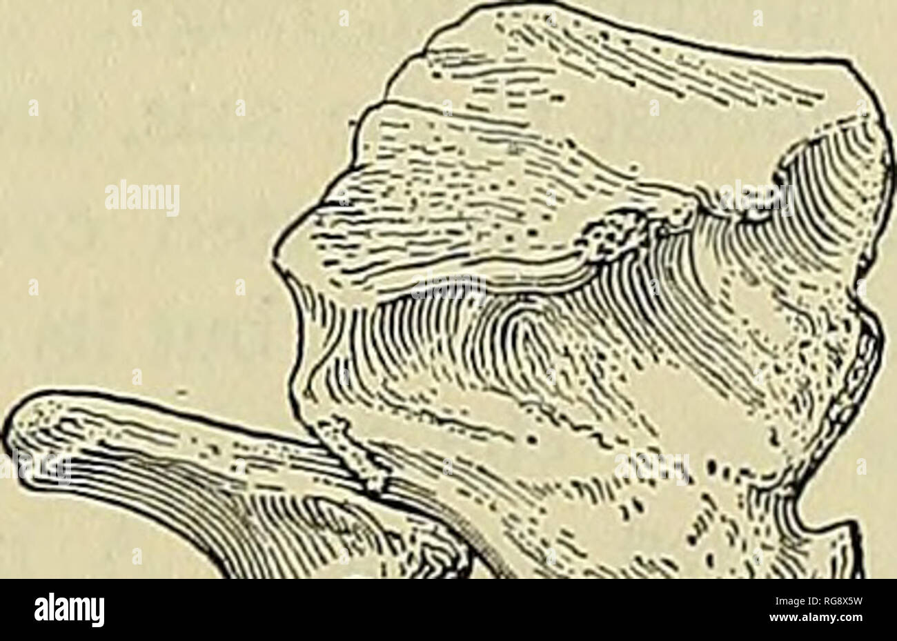 Transverse process of the atlas hi-res stock photography and images - Alamy