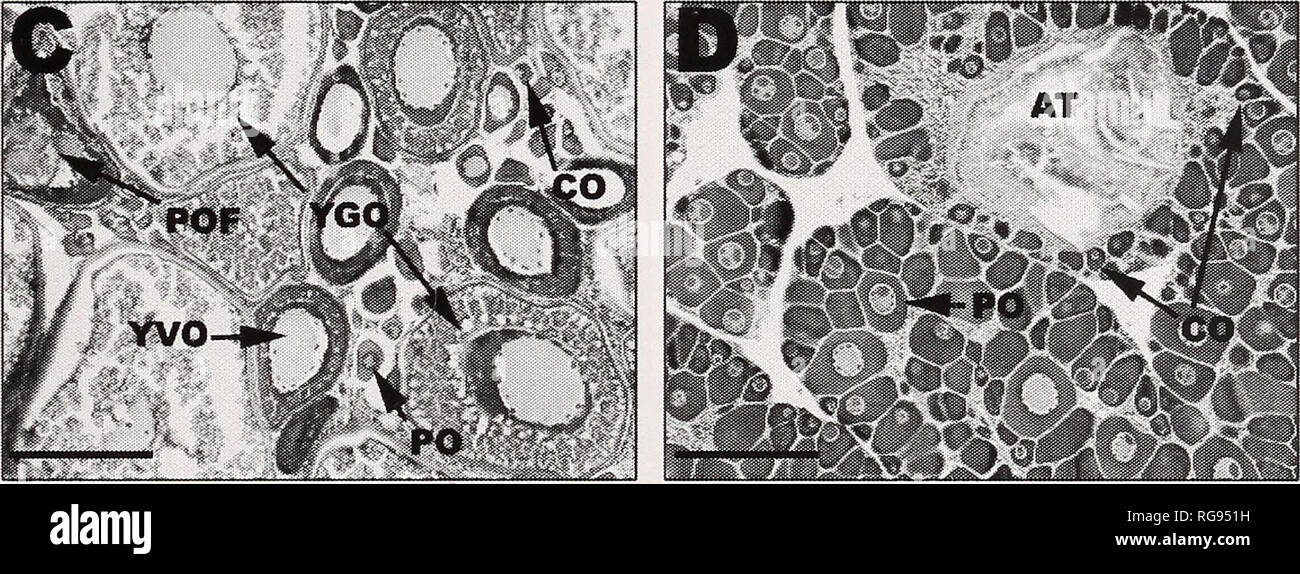 Atretic follicle hi-res stock photography and images - Alamy