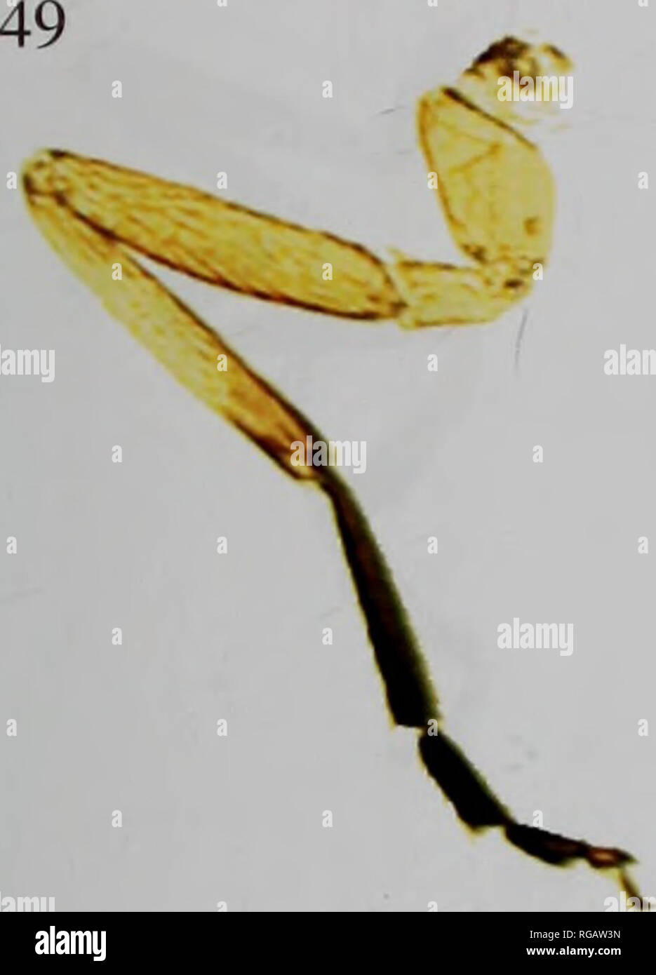 Onchocerciasis hi-res stock photography and images - Alamy