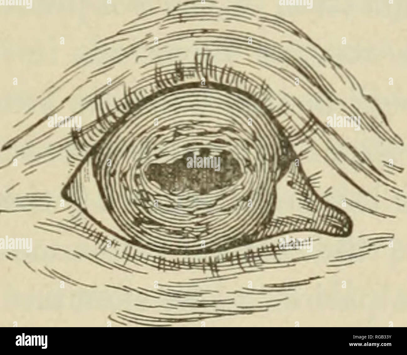 Pericorneal hi-res stock photography and images - Alamy