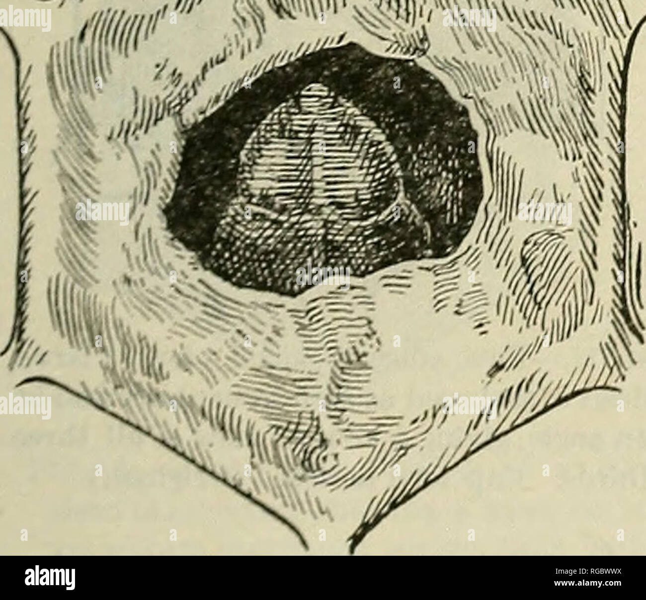 Brood sac hi-res stock photography and images - Alamy