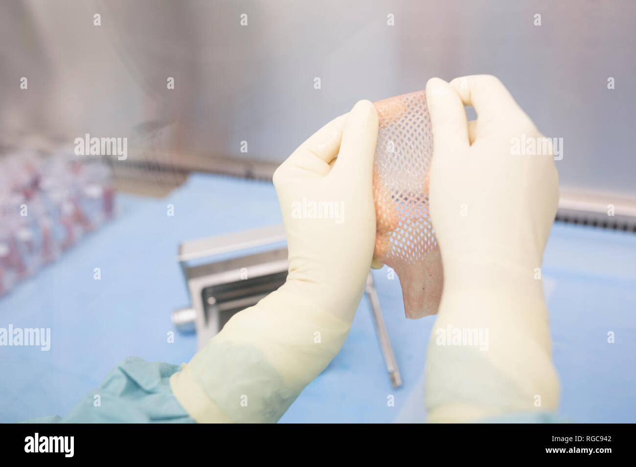 Skin graft hi-res stock photography and images - Alamy