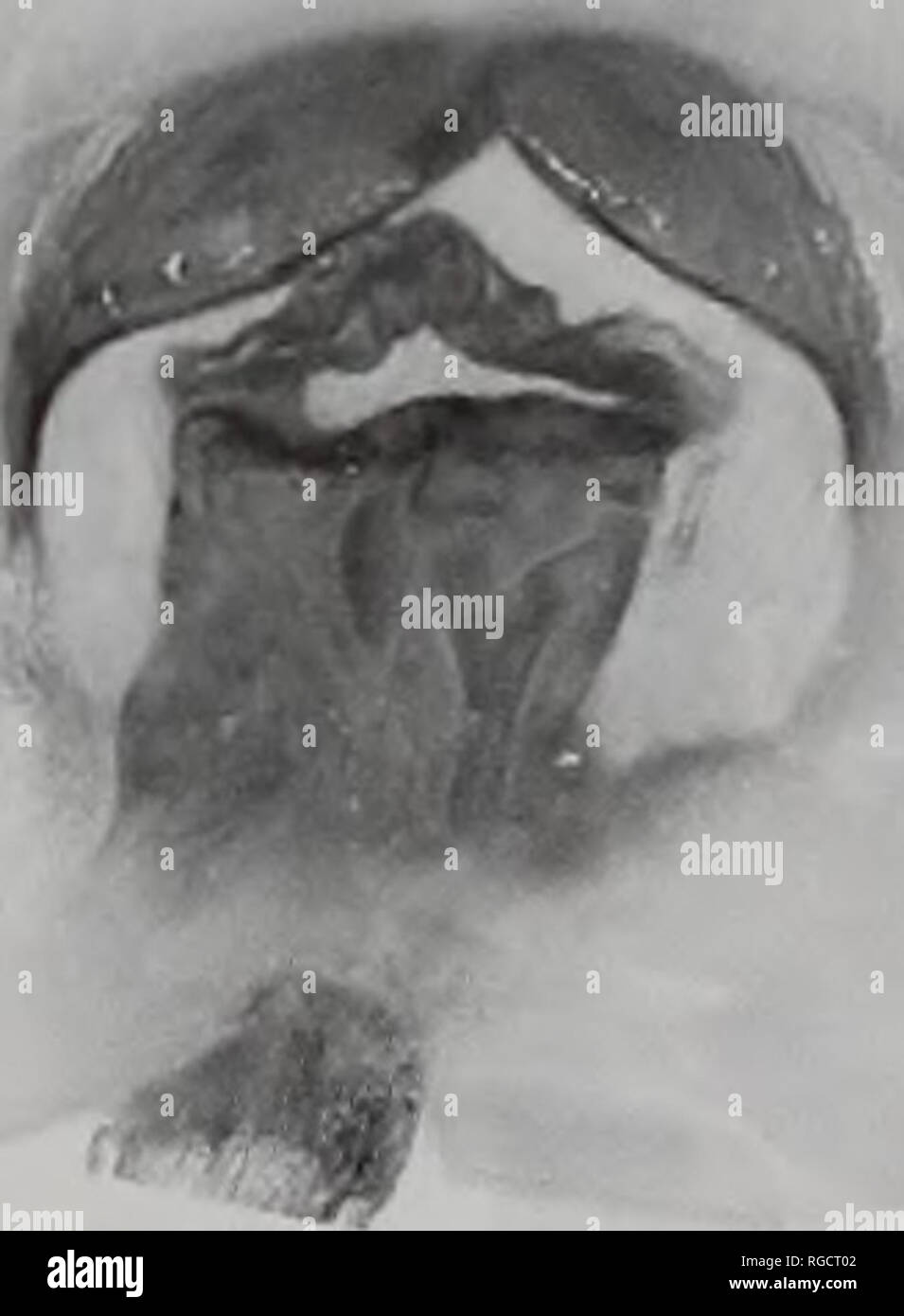 107 reg hi-res stock photography and images - Alamy