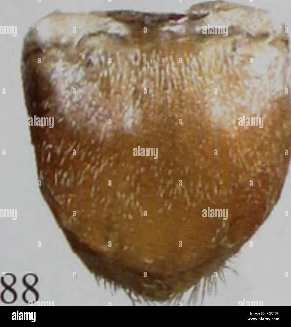 Onchocerciasis High Resolution Stock Photography and Images - Alamy