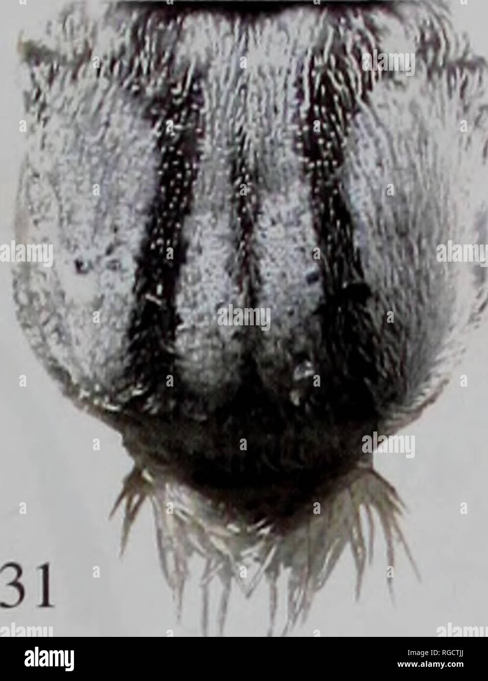 Onchocerciasis hi-res stock photography and images - Alamy