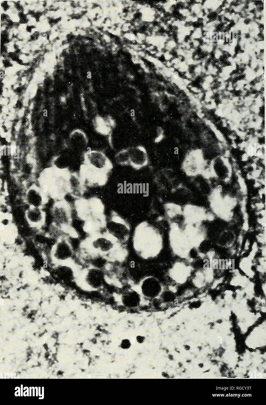 Cytopharynx hi-res stock photography and images - Alamy