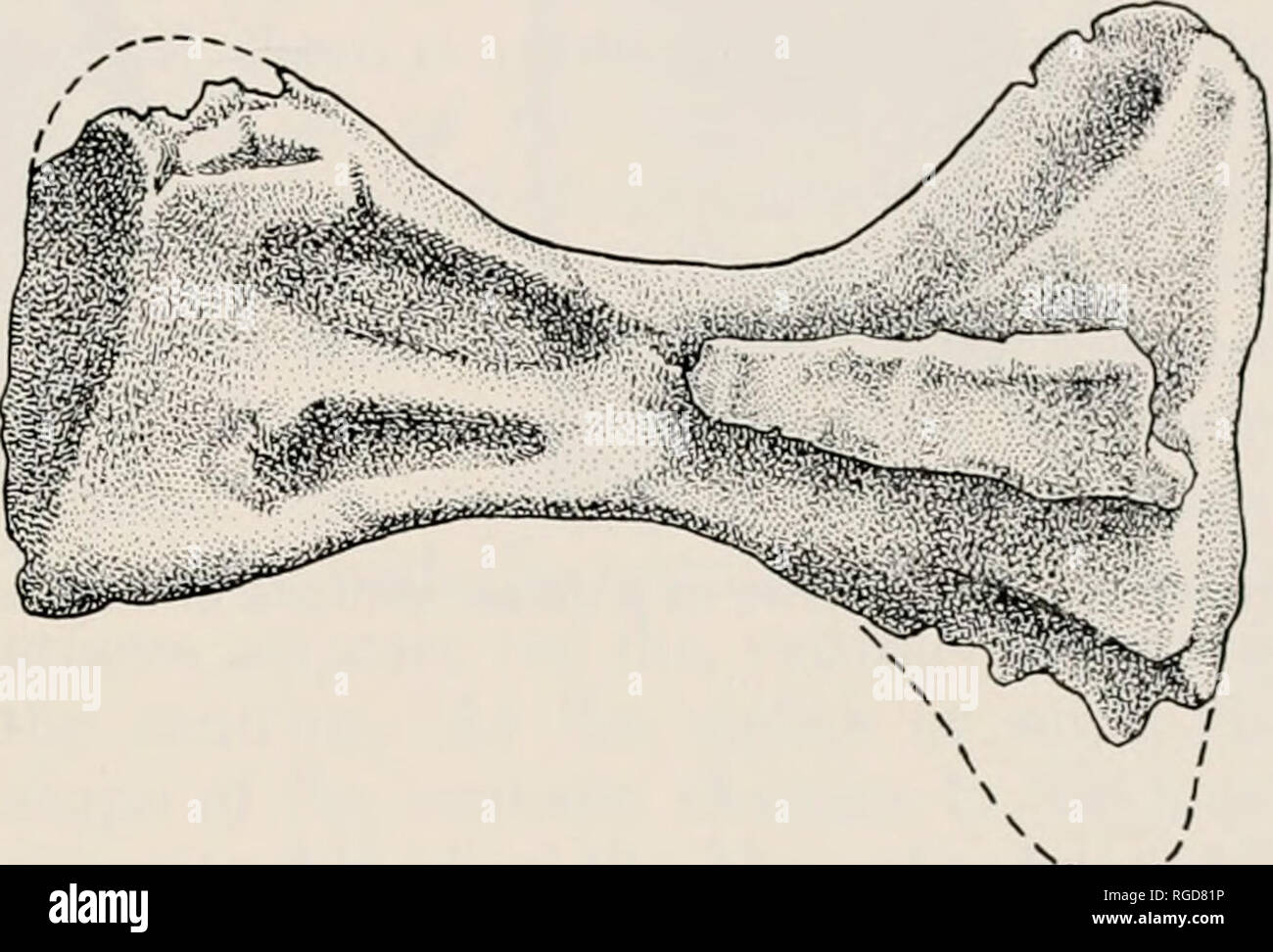 Transverse processes of cervical vertebrae hi-res stock photography and ...