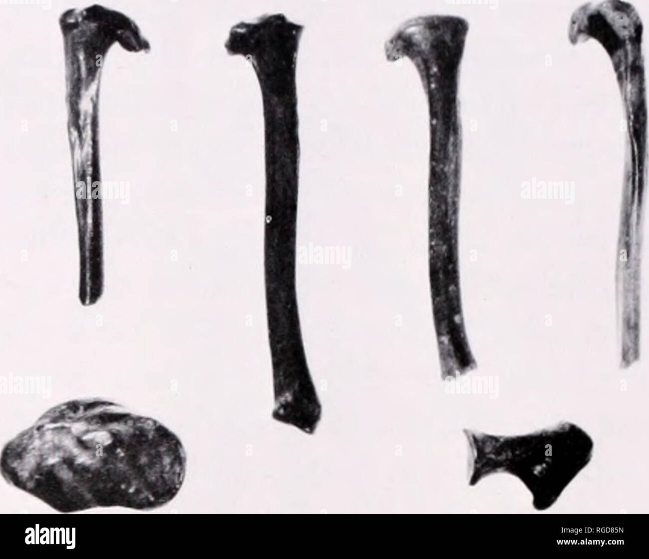 Proximal tibia hi-res stock photography and images - Alamy