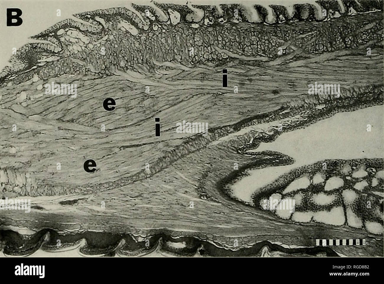 Left Parasagittal High Resolution Stock Photography and Images - Alamy