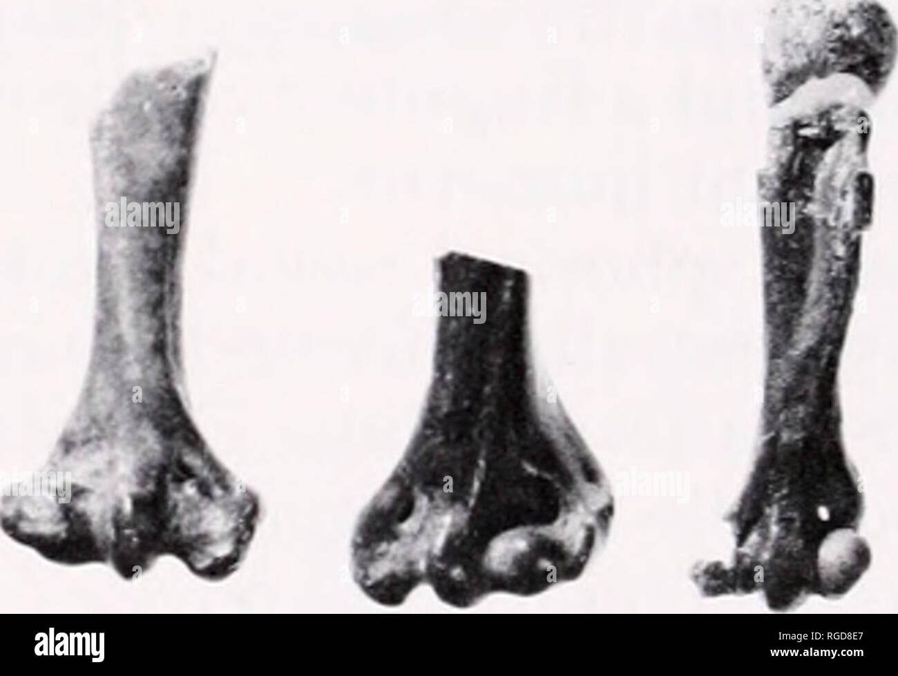 Proximal humerus hi-res stock photography and images - Alamy