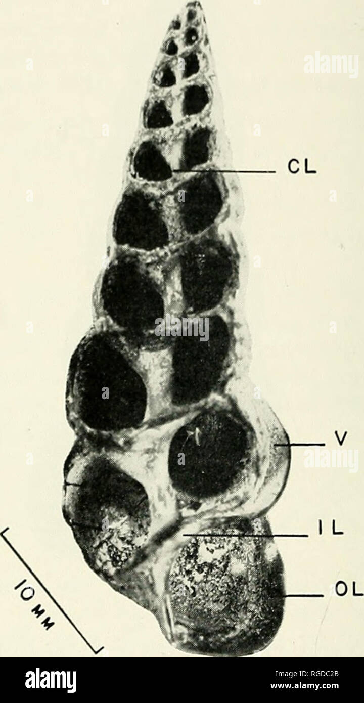 Muscular layers of foot hi-res stock photography and images - Alamy