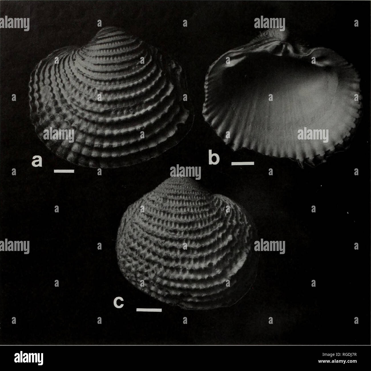 Adductor muscle scar hi-res stock photography and images - Alamy