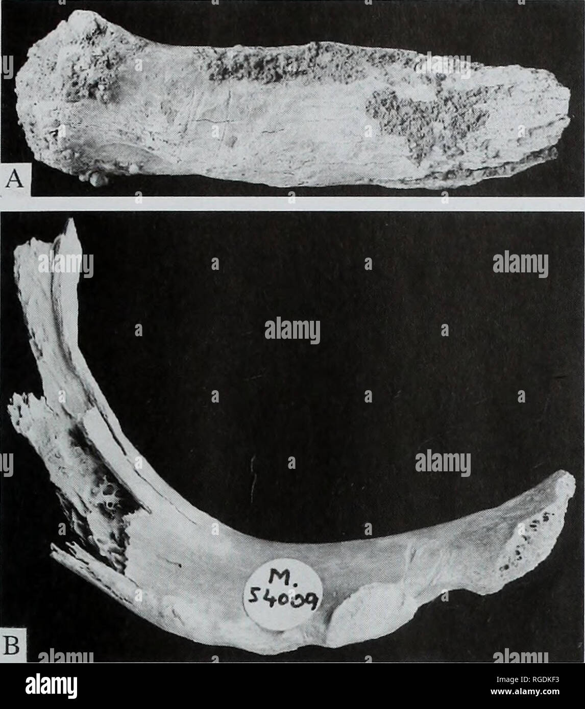 Human remains series hi-res stock photography and images - Alamy