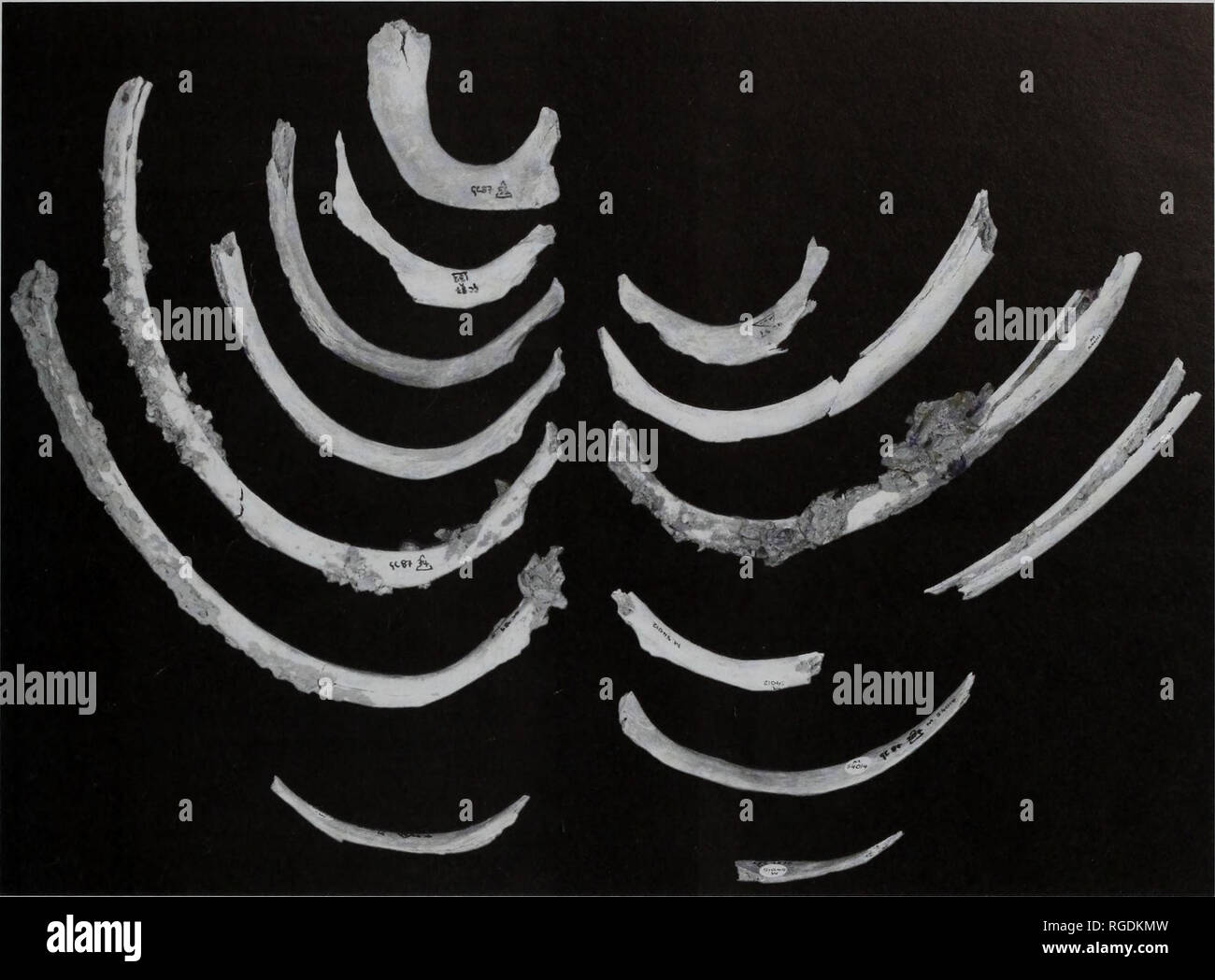 Sternal articular surface hi-res stock photography and images - Alamy