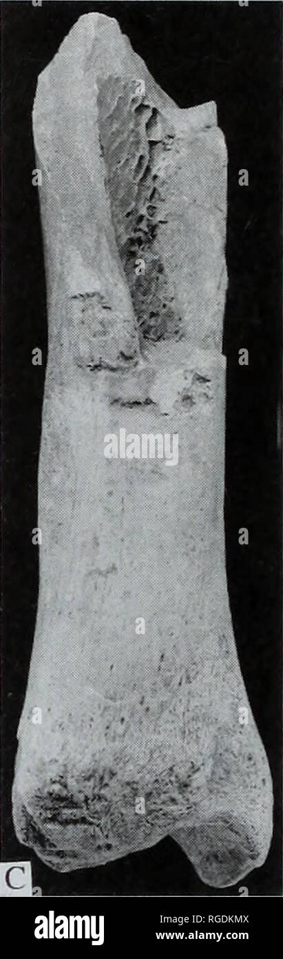 Distal tibia hi-res stock photography and images - Alamy