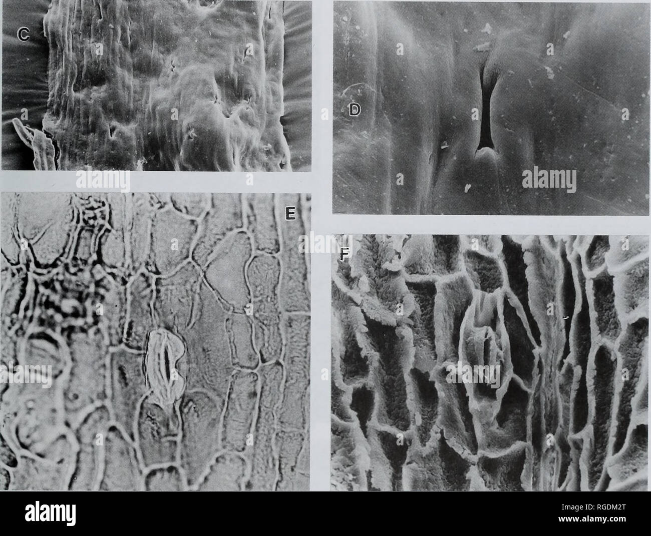 Stoma sem hi-res stock photography and images - Alamy