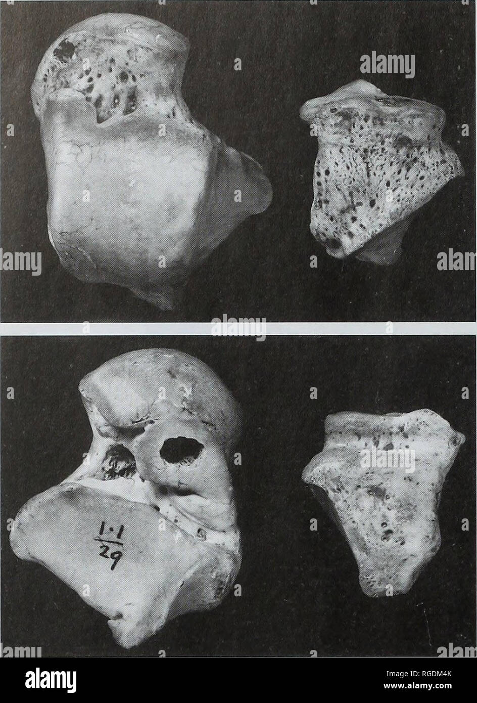 Maximum Skull Breadth