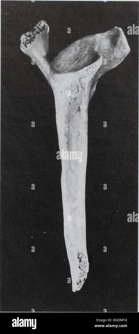 Scapula superior view hi-res stock photography and images - Alamy