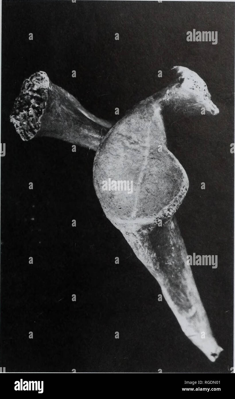 Scapula superior view hi-res stock photography and images - Alamy