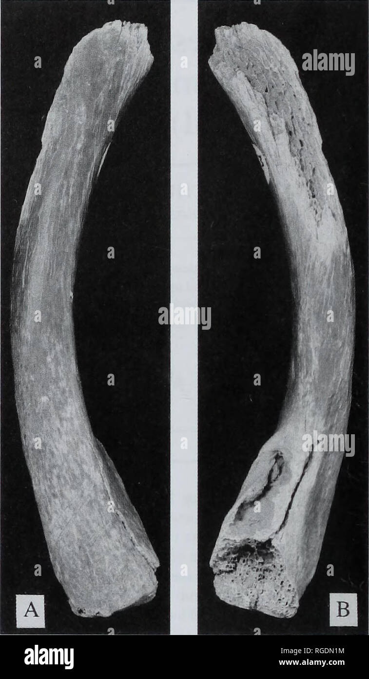 Acromial facet hi-res stock photography and images - Alamy