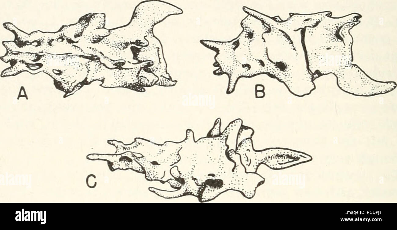 Lumbar facet joint hi-res stock photography and images - Alamy
