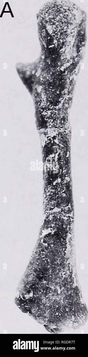 Femoral shaft hi-res stock photography and images - Alamy