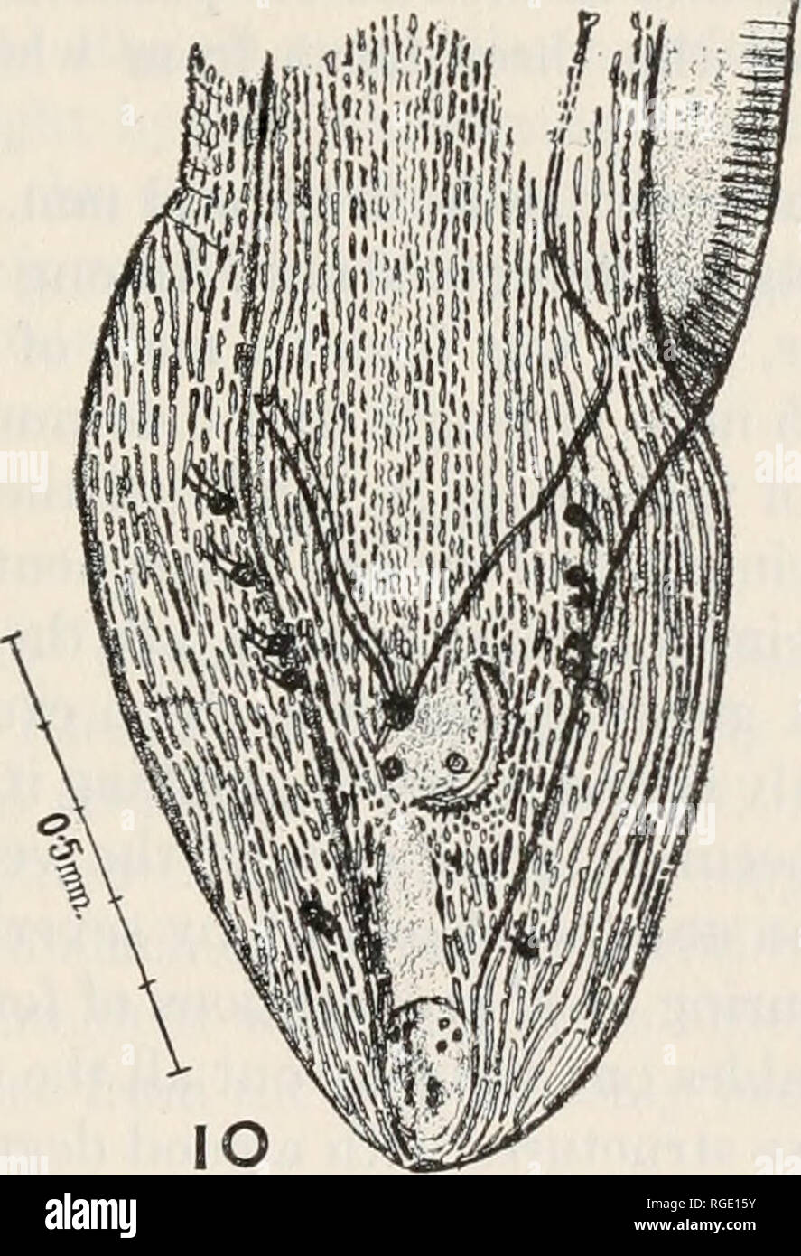 Cervical ring hi-res stock photography and images - Alamy