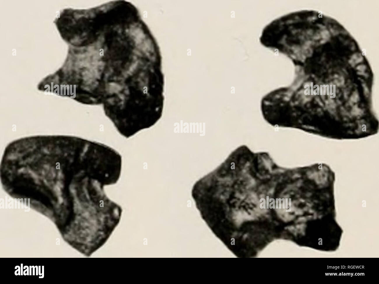 Tarsal plate hi-res stock photography and images - Alamy