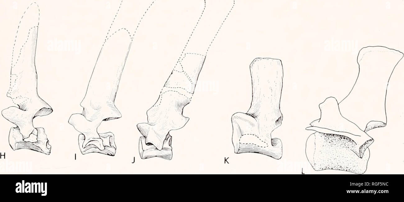 Cervical vertebrae 7 hi-res stock photography and images - Alamy