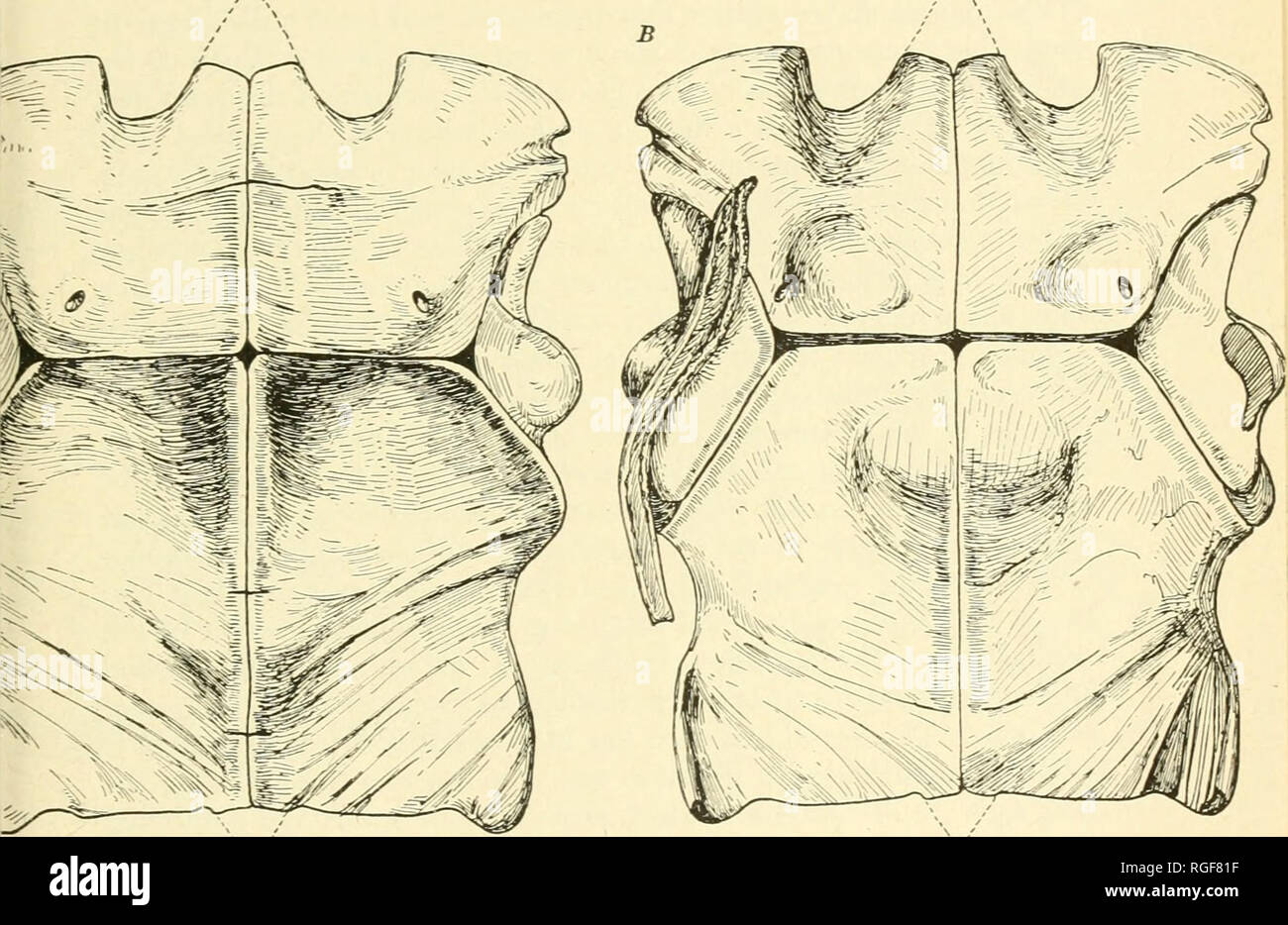 Acetabular notch hi-res stock photography and images - Alamy